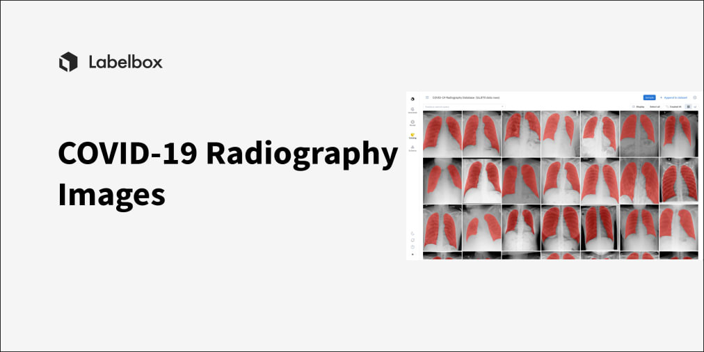 COVID-19 Radiography Images